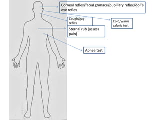 Brain%20death%20final.pptx | Brain and Nervous System Disorders ...