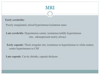 Brain abscess by waheed | PPT