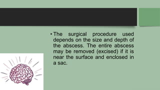 Brain abscess | PPTX
