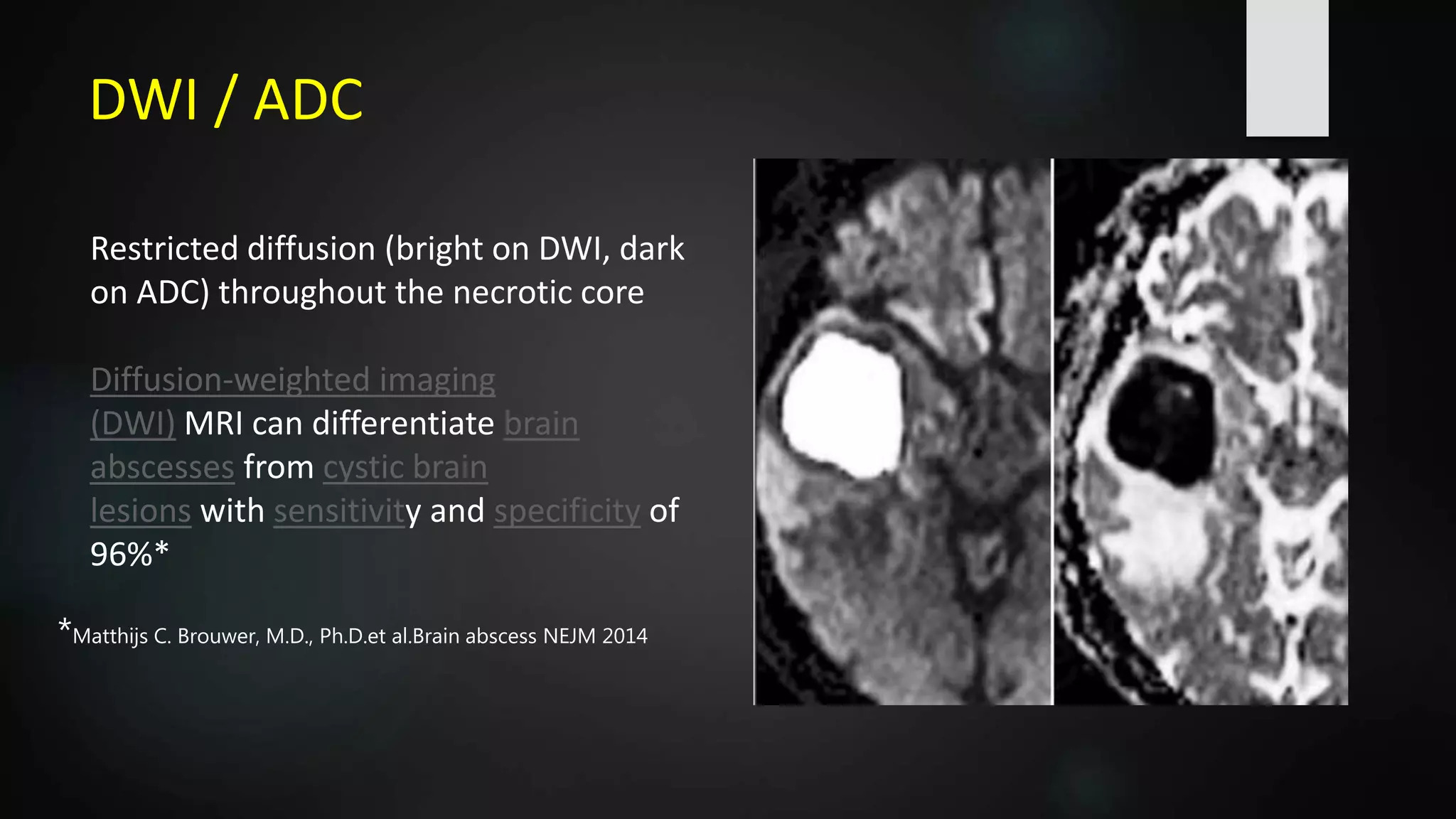 Brain abscess | PPTX