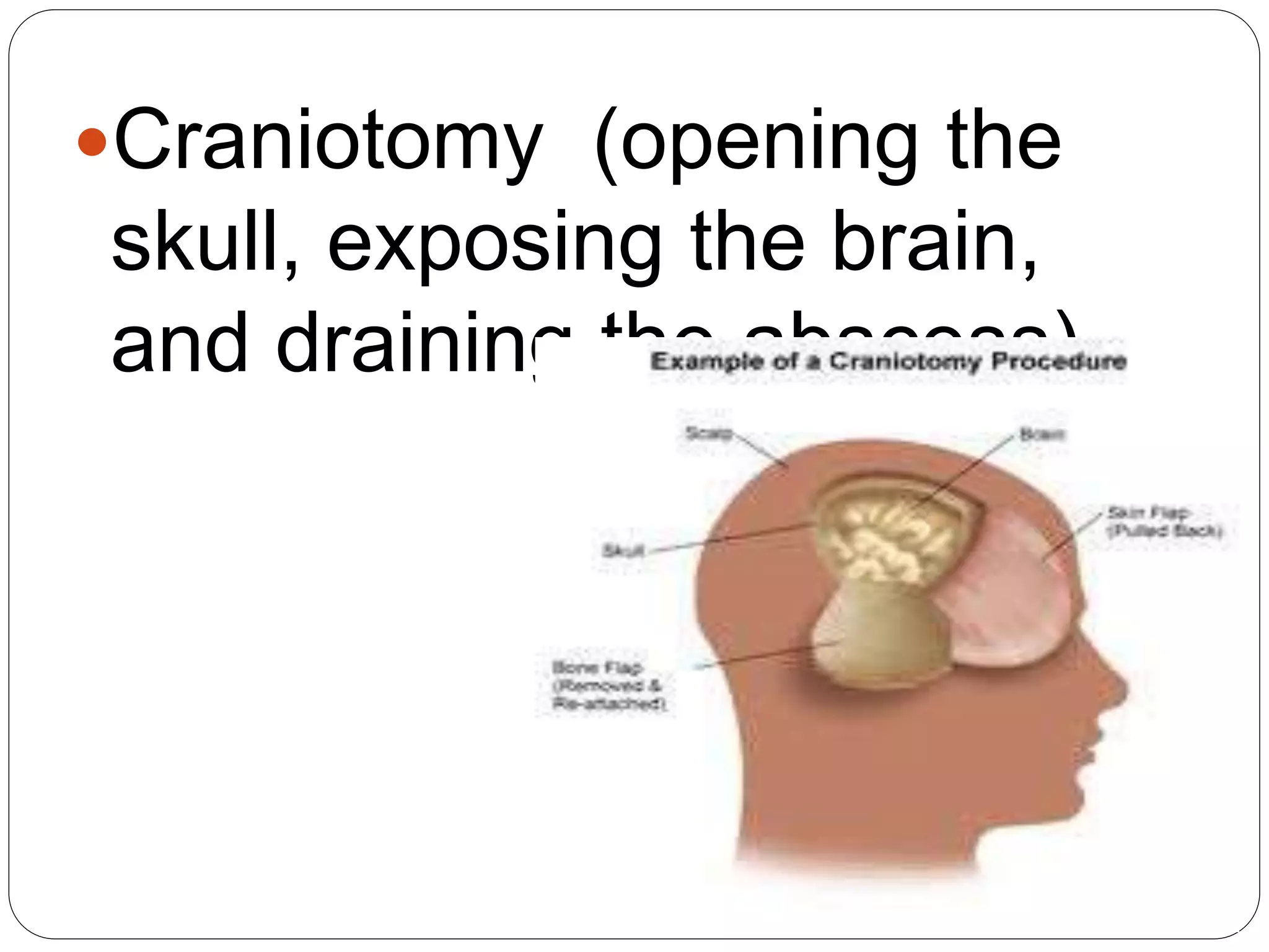 Brain abscess | PPTX