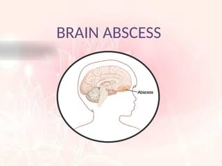 BRAIN ABSCESS.pptx dsgswgewgwhtRGTWGRGRDT | PPTX