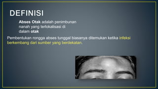 Brain abscess ec sinusitis | PPT