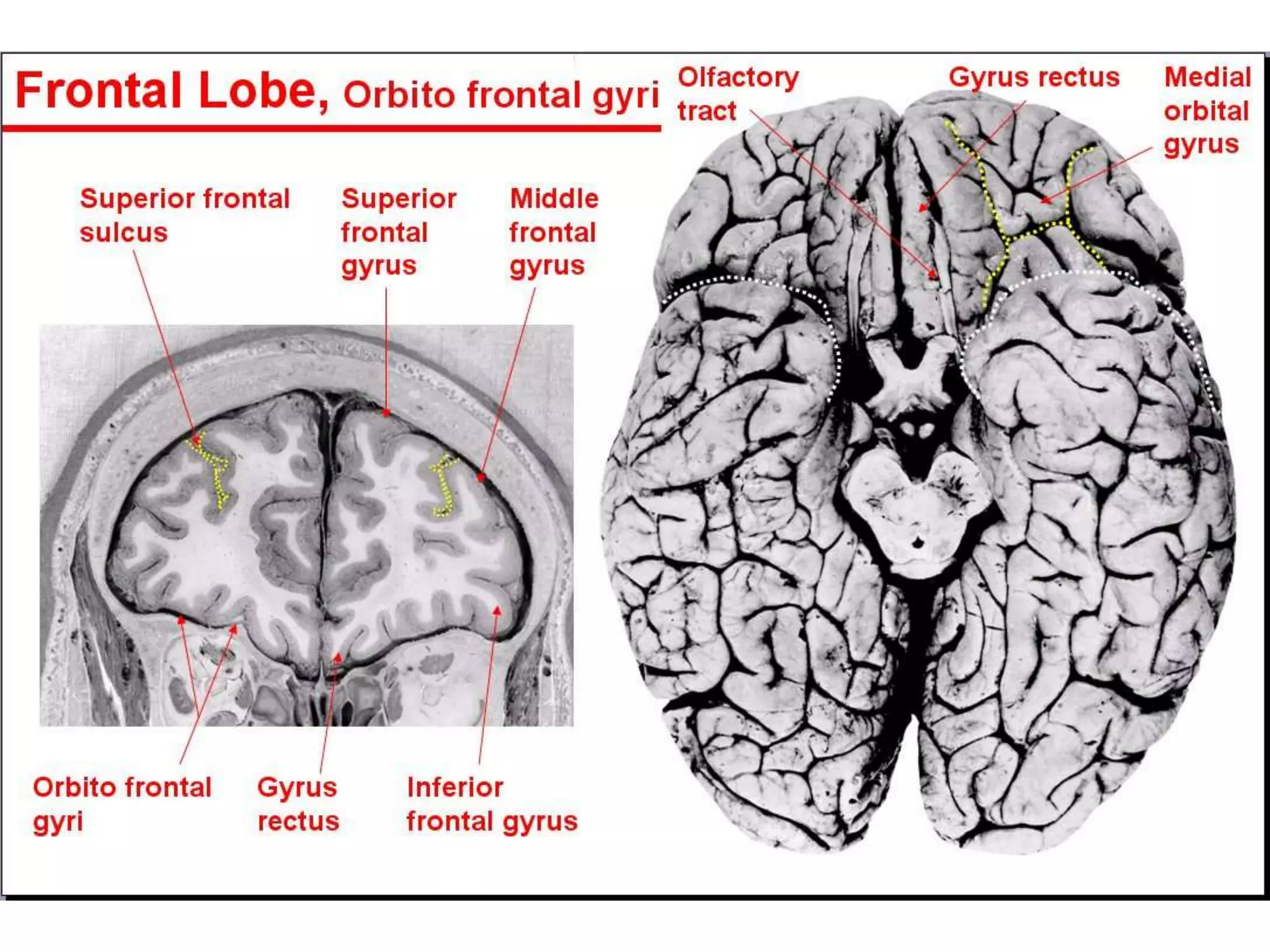 Anatomy of brain sulcus and gyrus - Dr.Sajith MD RD | PPTX