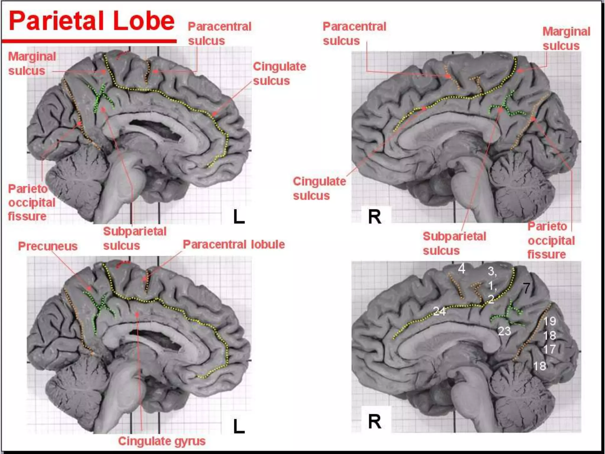 Anatomy of brain sulcus and gyrus - Dr.Sajith MD RD | PPTX | Brain and ...