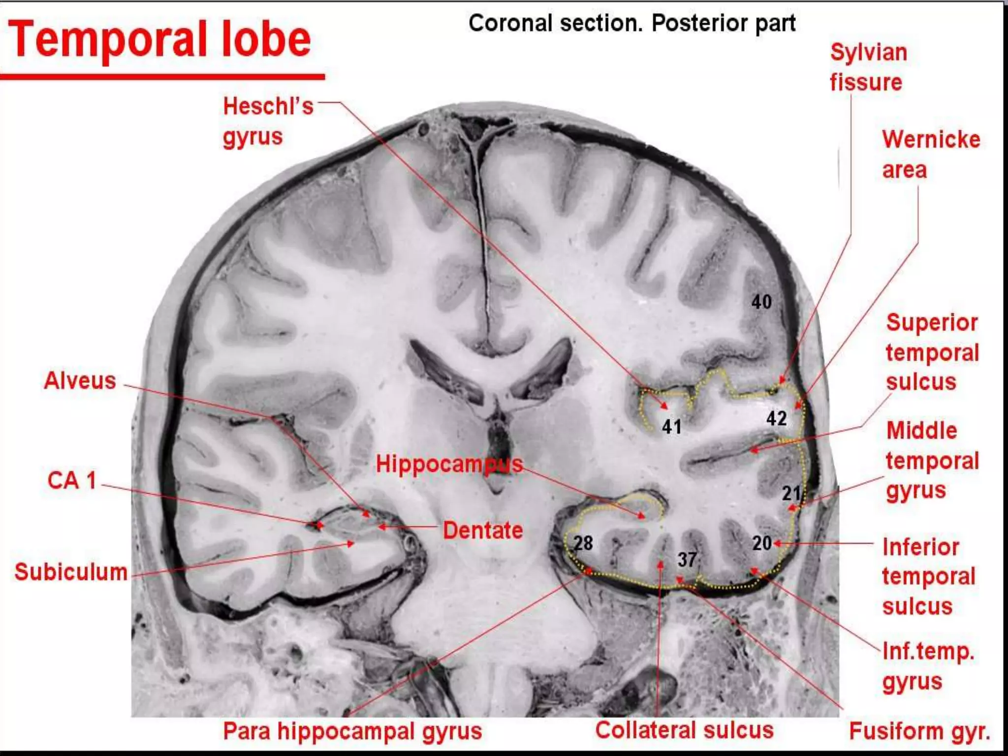 Anatomy of brain sulcus and gyrus - Dr.Sajith MD RD | PPTX