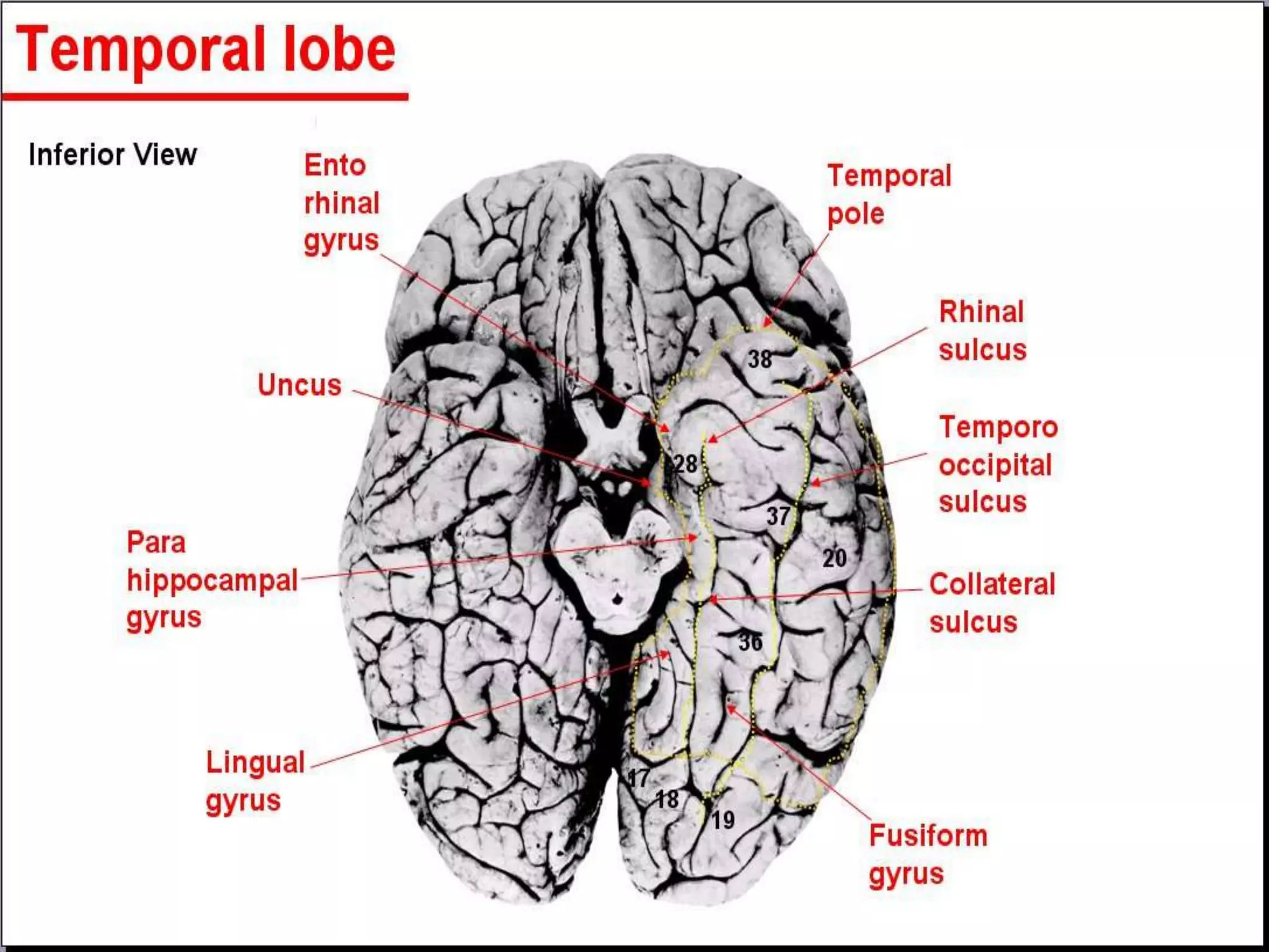 Anatomy of brain sulcus and gyrus - Dr.Sajith MD RD | PPTX