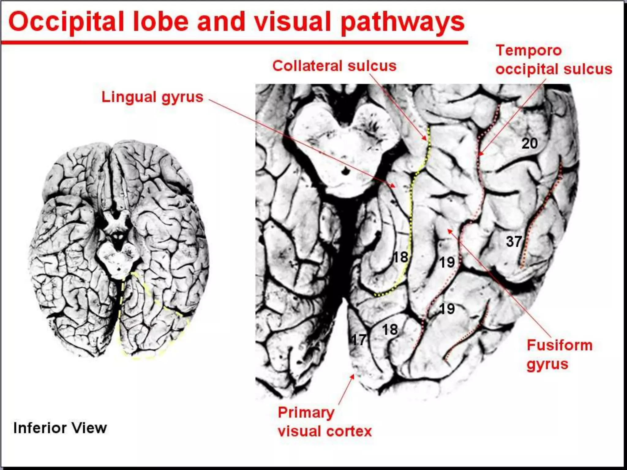 Anatomy of brain sulcus and gyrus - Dr.Sajith MD RD | PPTX | Brain and ...
