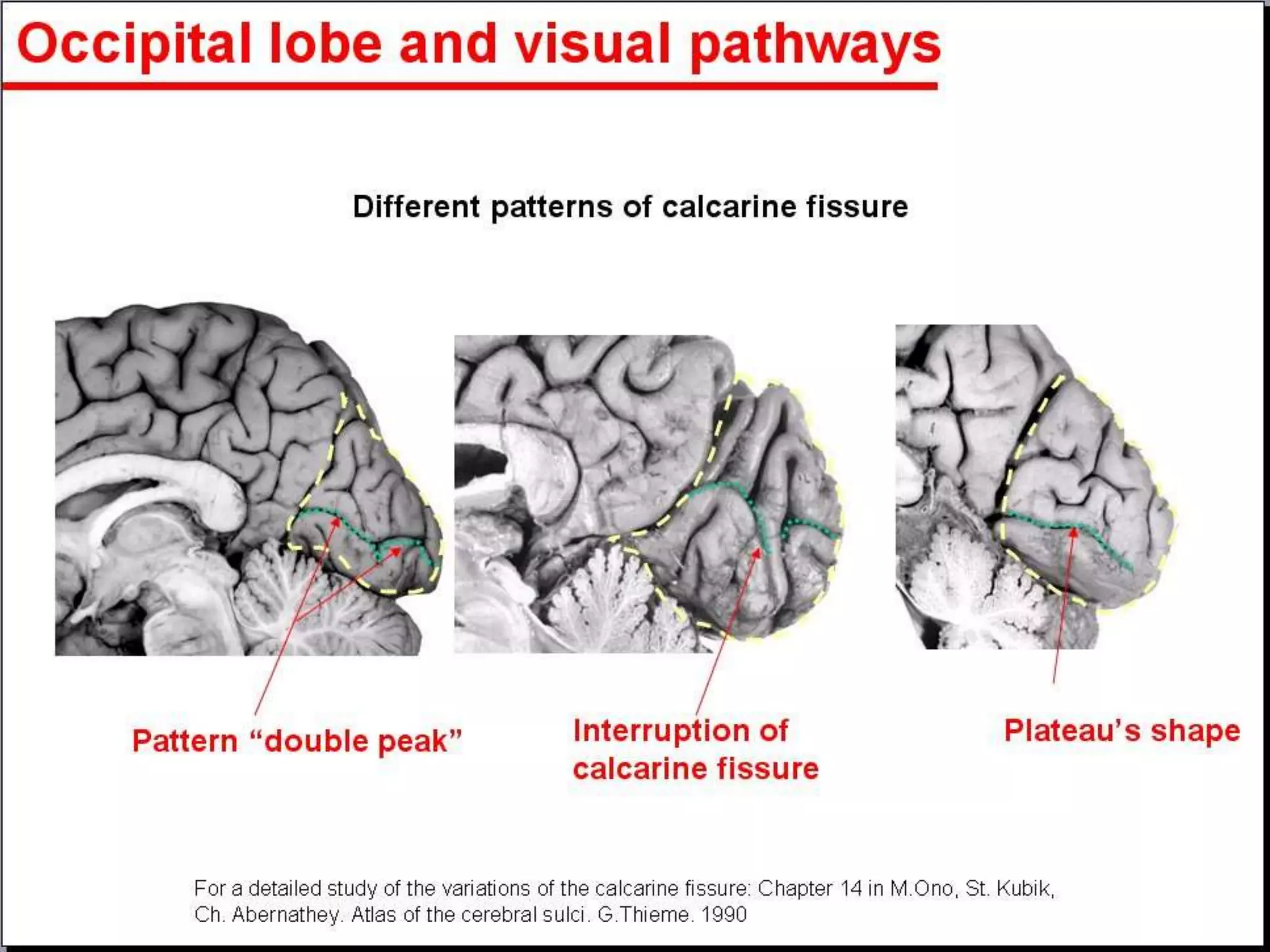 Anatomy of brain sulcus and gyrus - Dr.Sajith MD RD | PPTX | Brain and ...