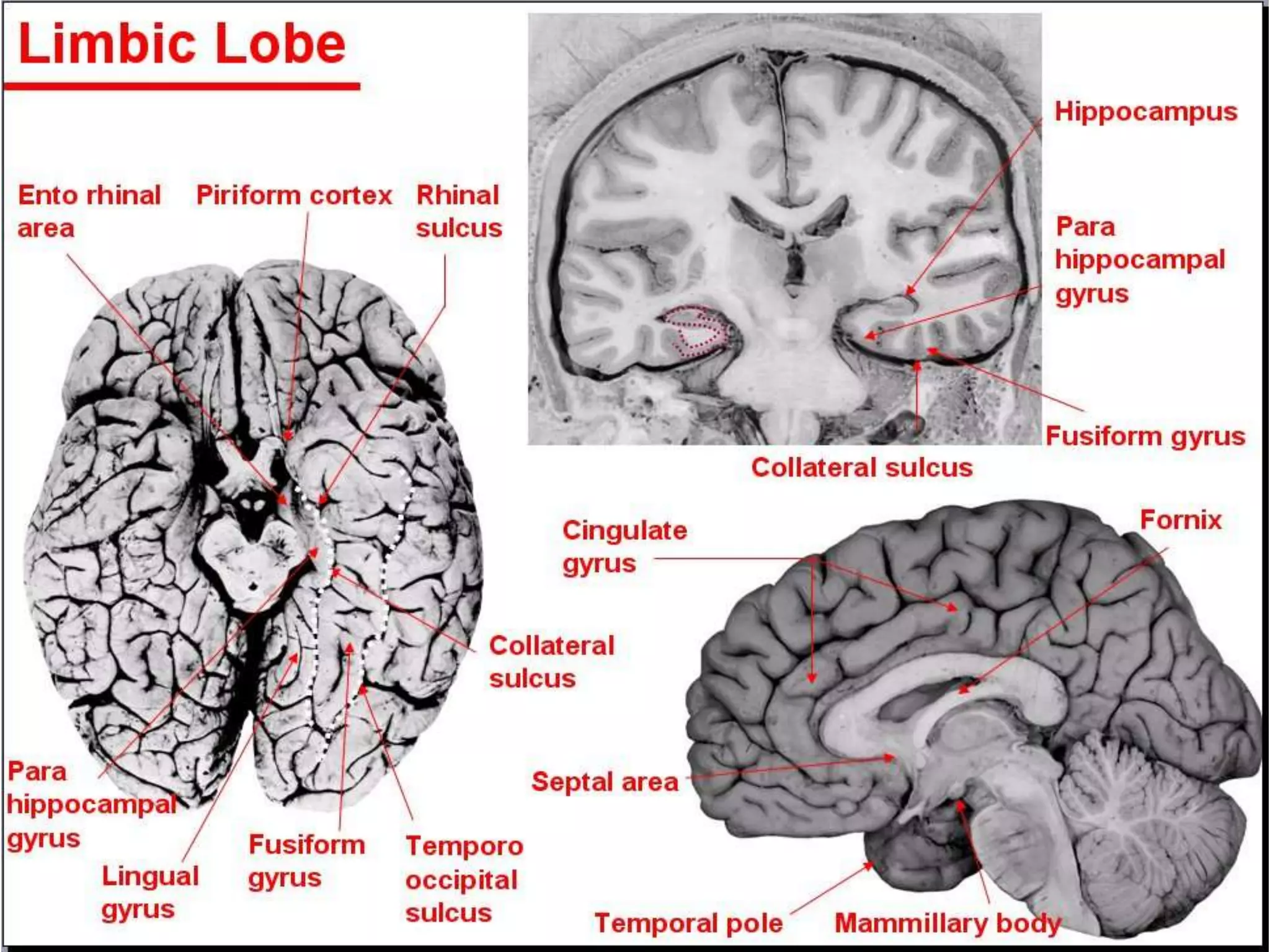 Anatomy of brain sulcus and gyrus - Dr.Sajith MD RD | PPTX