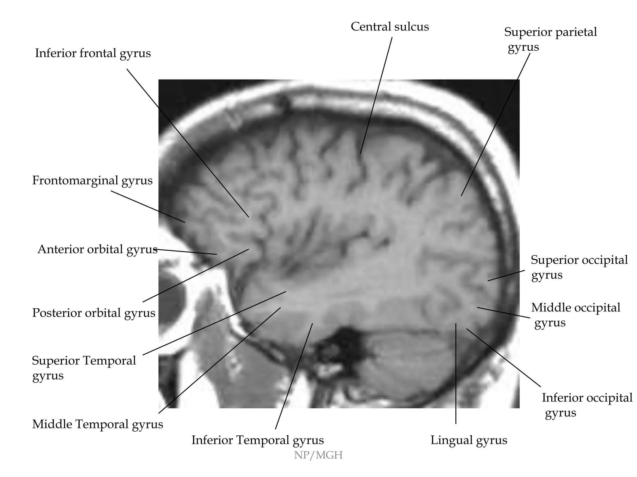 Anatomy of brain sulcus and gyrus - Dr.Sajith MD RD | PPTX
