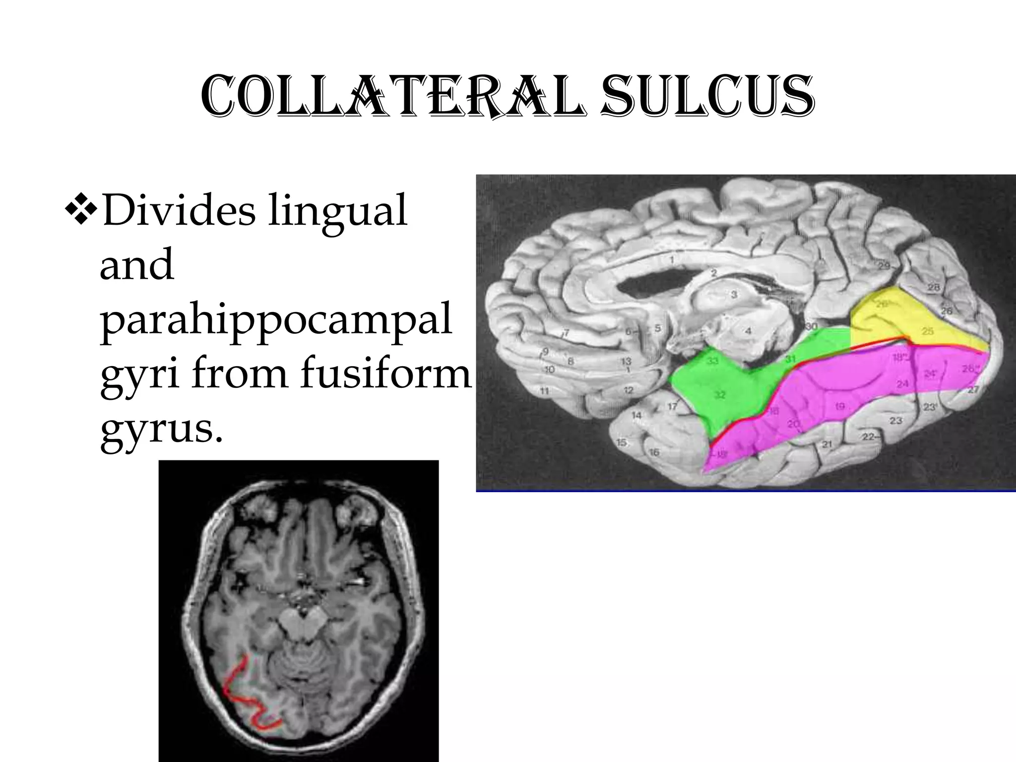 Anatomy of brain sulcus and gyrus - Dr.Sajith MD RD | PPTX