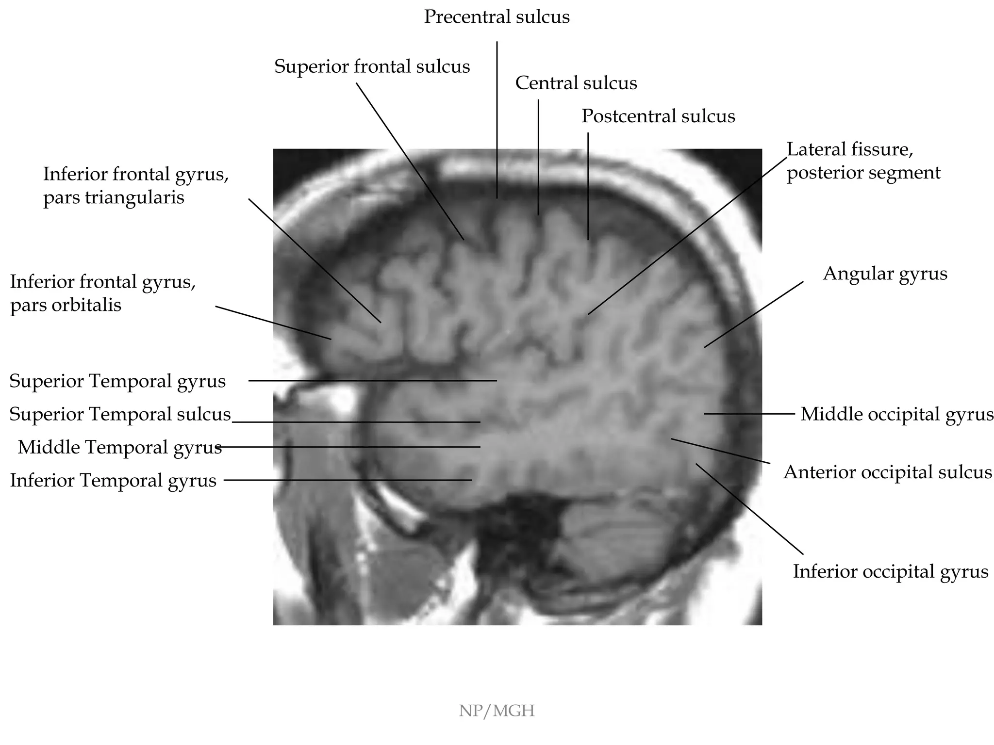 Anatomy of brain sulcus and gyrus - Dr.Sajith MD RD | PPTX