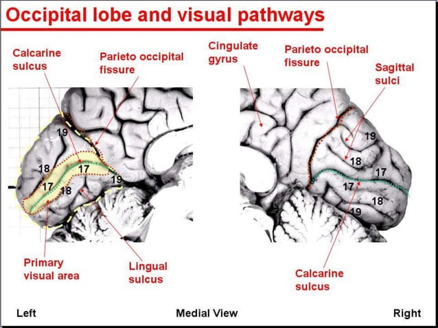 Anatomy of brain sulcus and gyrus - Dr.Sajith MD RD | PPTX | Brain and ...