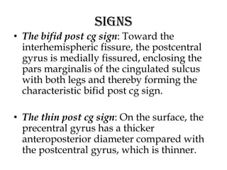 Anatomy of brain sulcus and gyrus - Dr.Sajith MD RD | PPTX