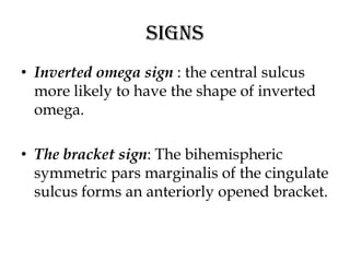 Anatomy of brain sulcus and gyrus - Dr.Sajith MD RD | PPTX