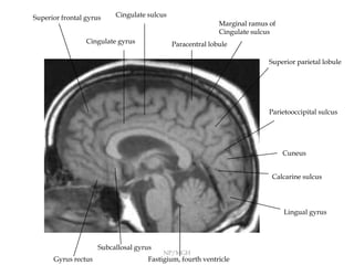Anatomy of brain sulcus and gyrus - Dr.Sajith MD RD | PPTX