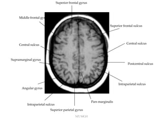 Anatomy of brain sulcus and gyrus - Dr.Sajith MD RD | PPTX