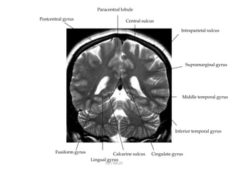 Anatomy of brain sulcus and gyrus - Dr.Sajith MD RD | PPTX | Brain and ...