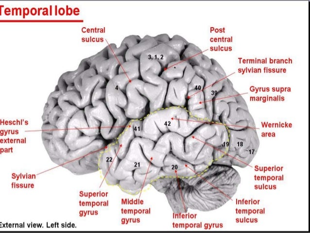 Anatomy of brain sulcus and gyrus - Dr.Sajith MD RD