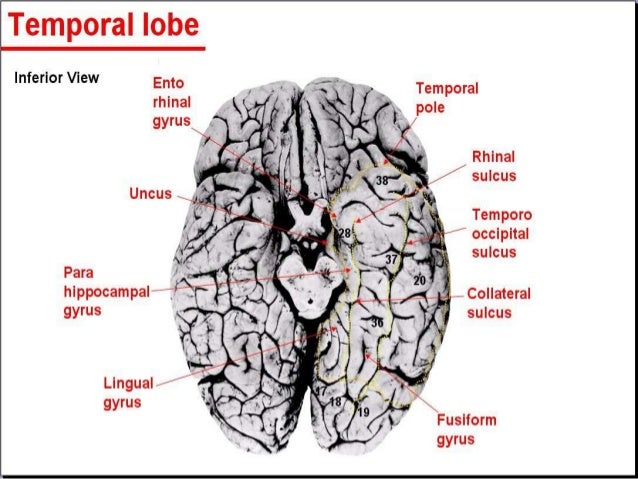 Anatomy of brain sulcus and gyrus - Dr.Sajith MD RD