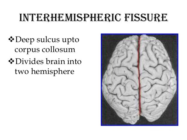 Anatomy of brain sulcus and gyrus - Dr.Sajith MD RD