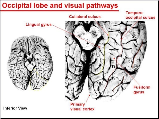 Anatomy of brain sulcus and gyrus - Dr.Sajith MD RD