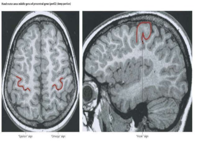 Anatomy of brain sulcus and gyrus - Dr.Sajith MD RD