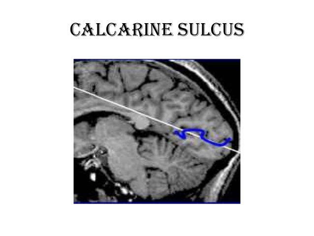 Anatomy of brain sulcus and gyrus - Dr.Sajith MD RD
