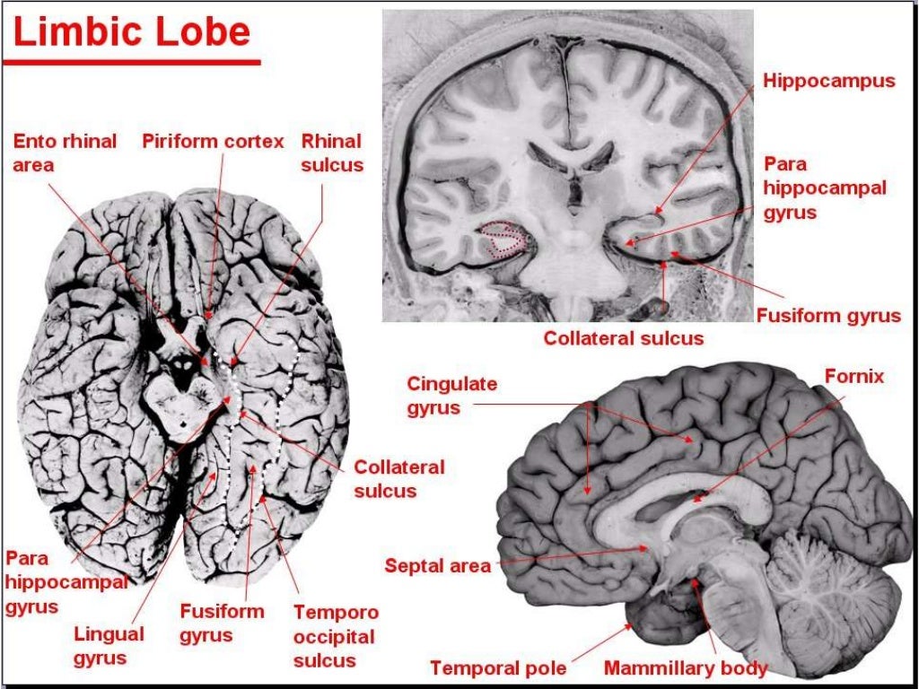 Anatomy of brain sulcus and gyrus - Dr.Sajith MD RD