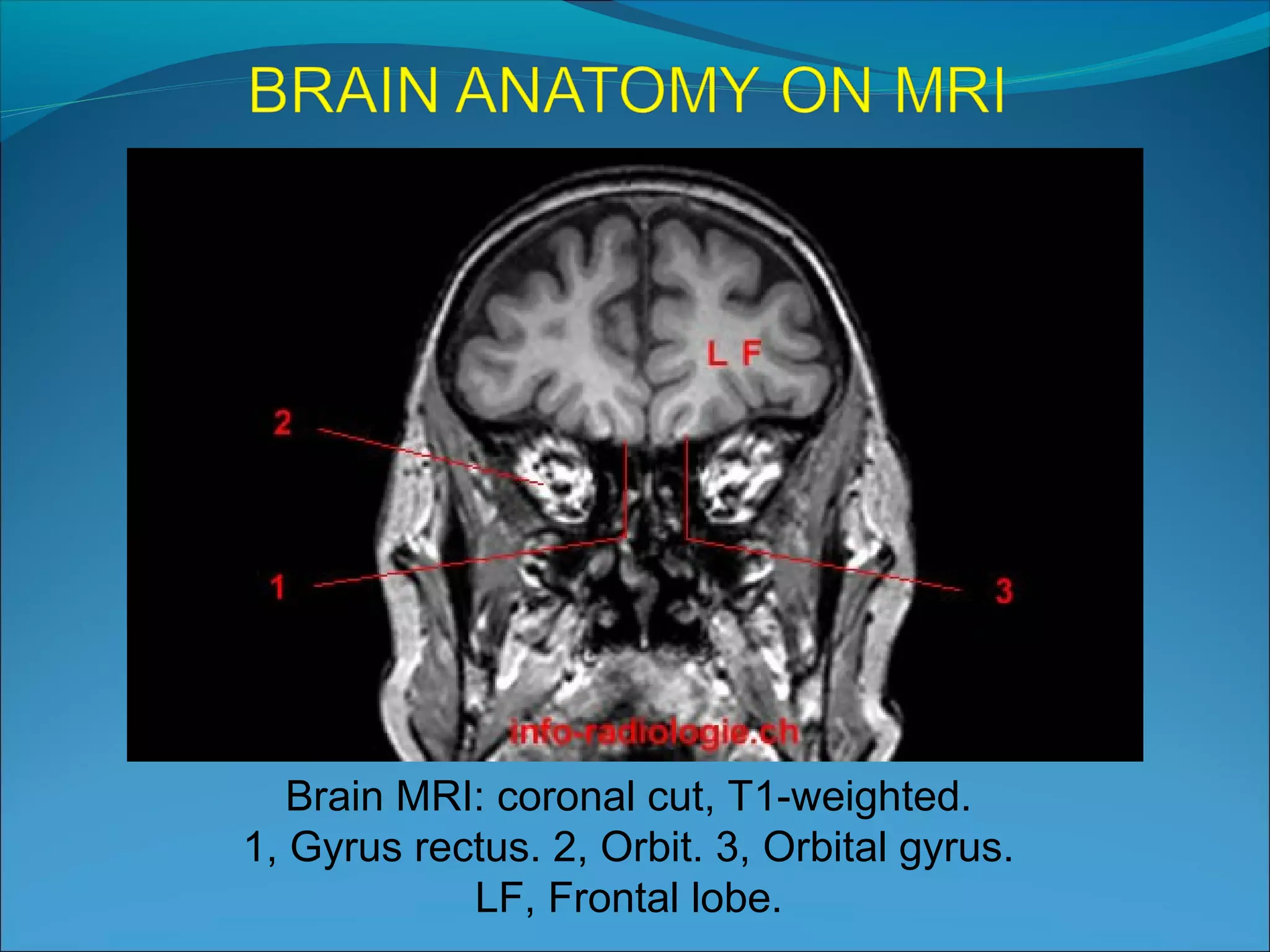 Brainanatomy 140926083919-phpapp02 | PDF