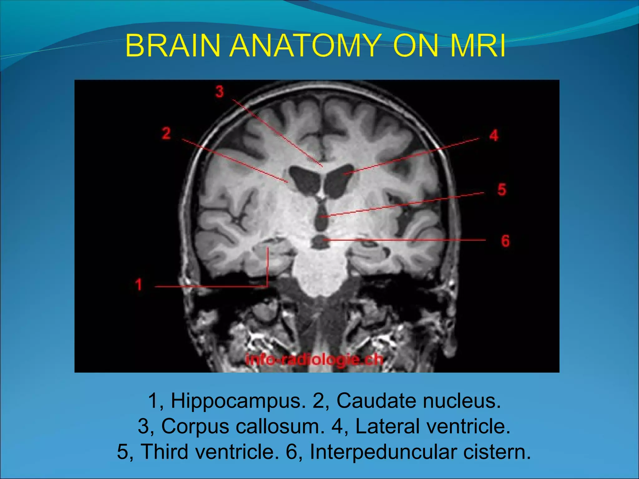 Brain anatomy | PPT
