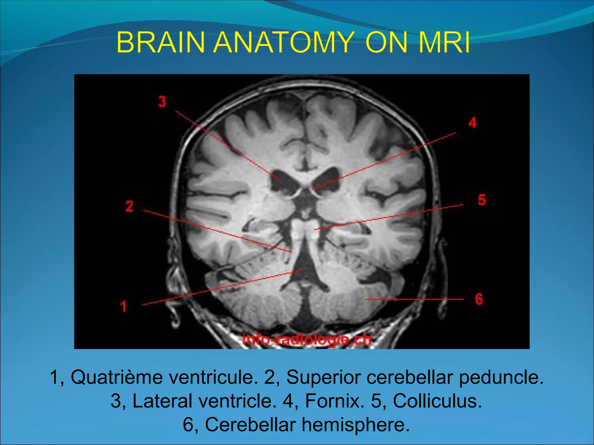 Brain anatomy | PPT