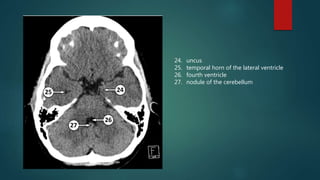 Brain anatomy | PPTX | Brain and Nervous System Disorders | Diseases ...