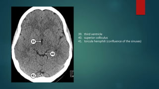 Brain anatomy | PPTX | Brain and Nervous System Disorders | Diseases ...