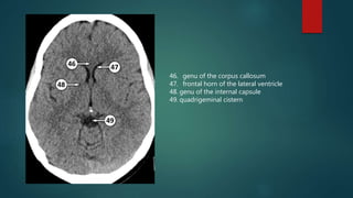 Brain anatomy | PPTX | Brain and Nervous System Disorders | Diseases ...