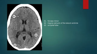 Brain anatomy | PPTX