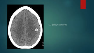 Brain anatomy | PPTX | Brain and Nervous System Disorders | Diseases ...