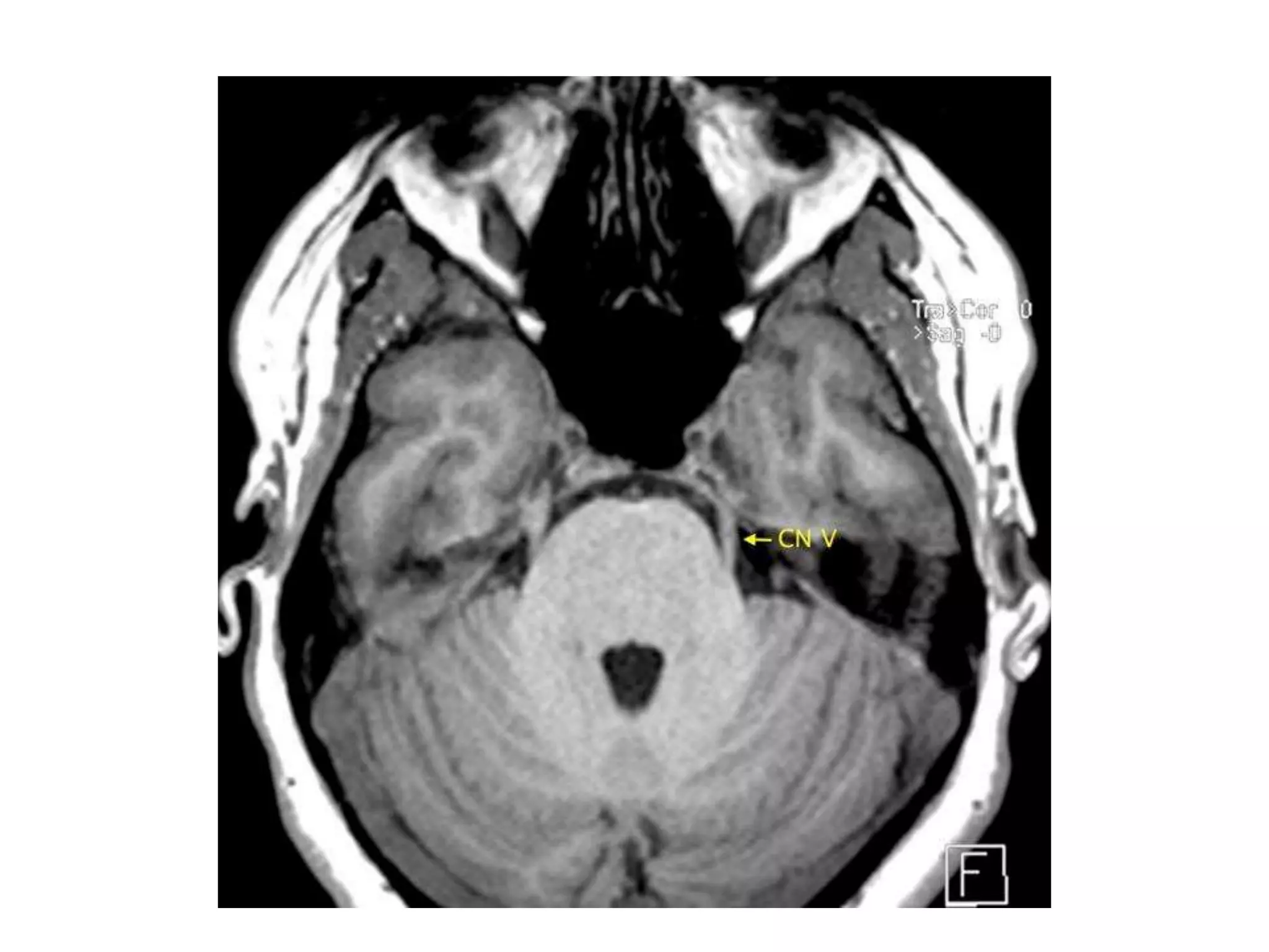 Brain anatomy ariunaa | PPTX