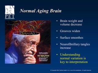 Brain anatomy and function power point | PPT