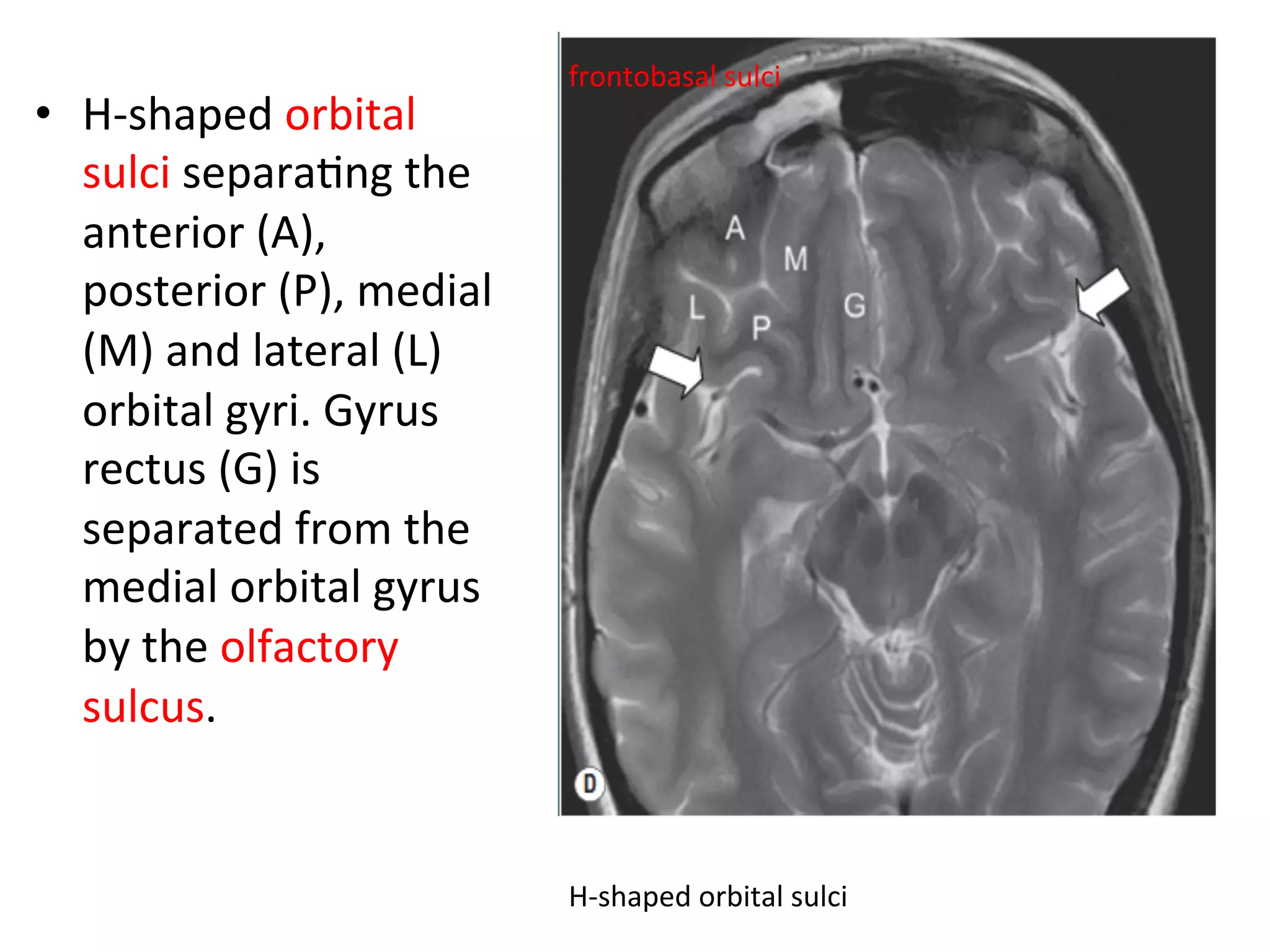 Brain anatomy new | PDF