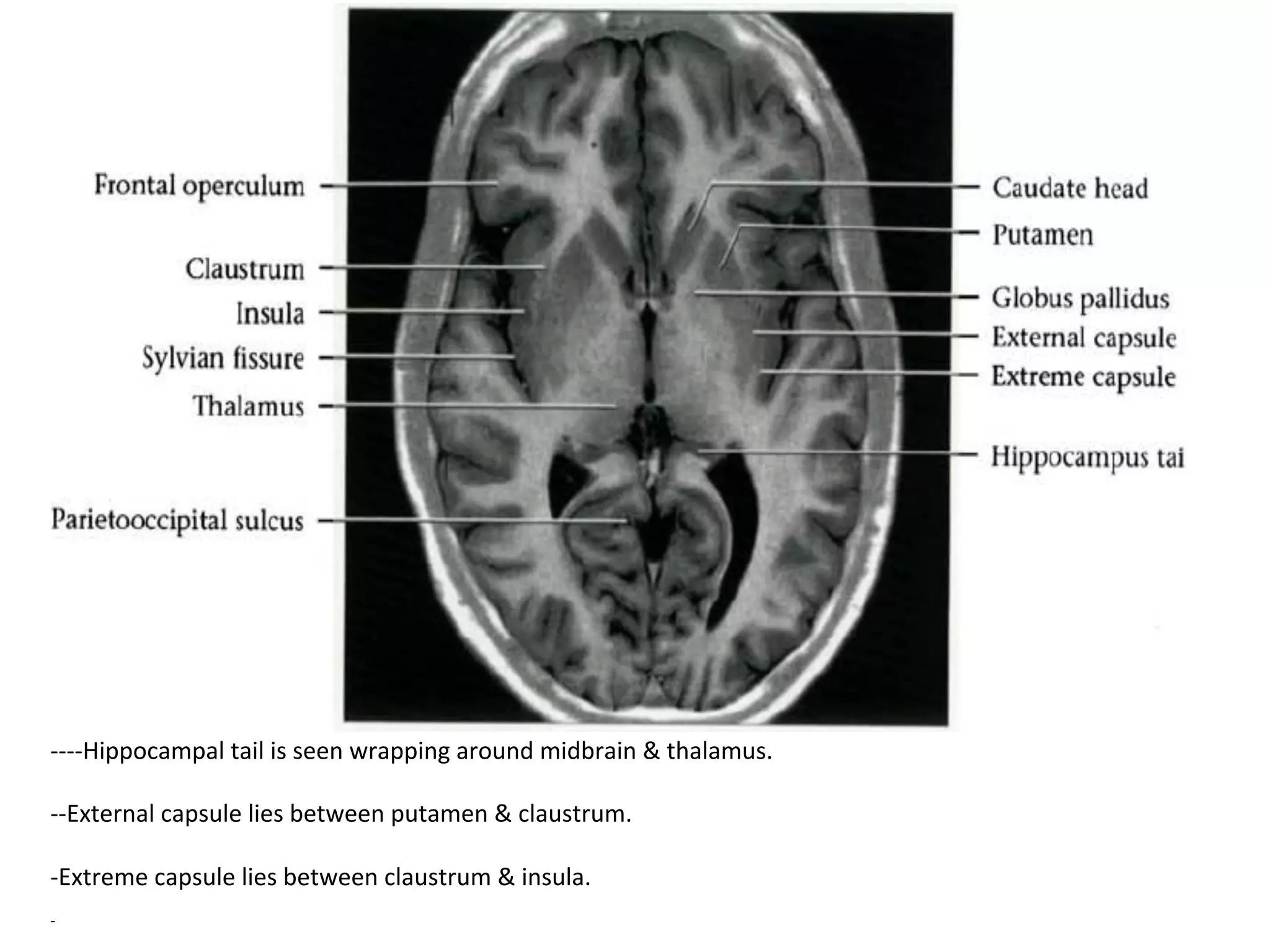 Brain anatomy new | PDF