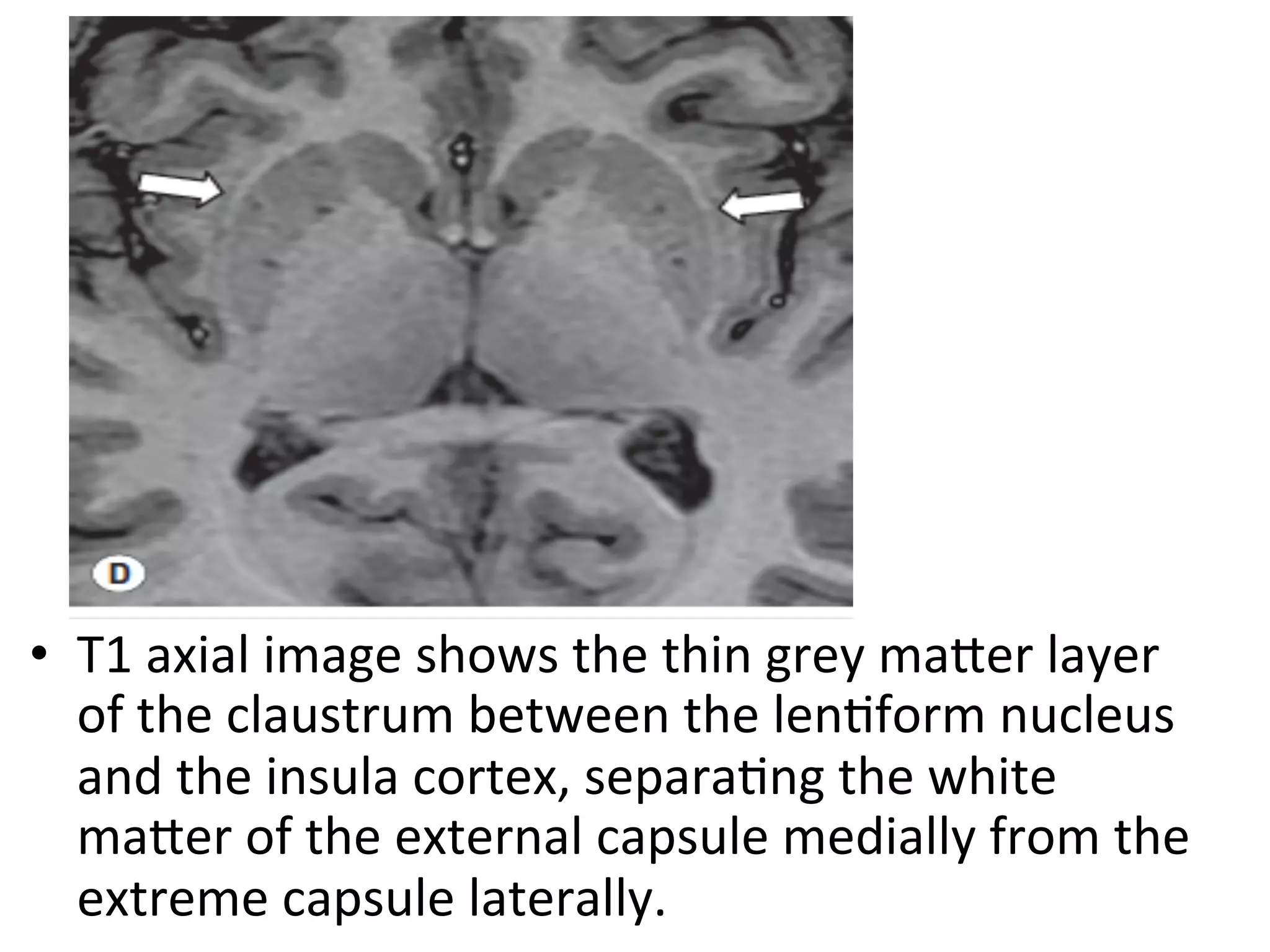 Brain anatomy new | PDF