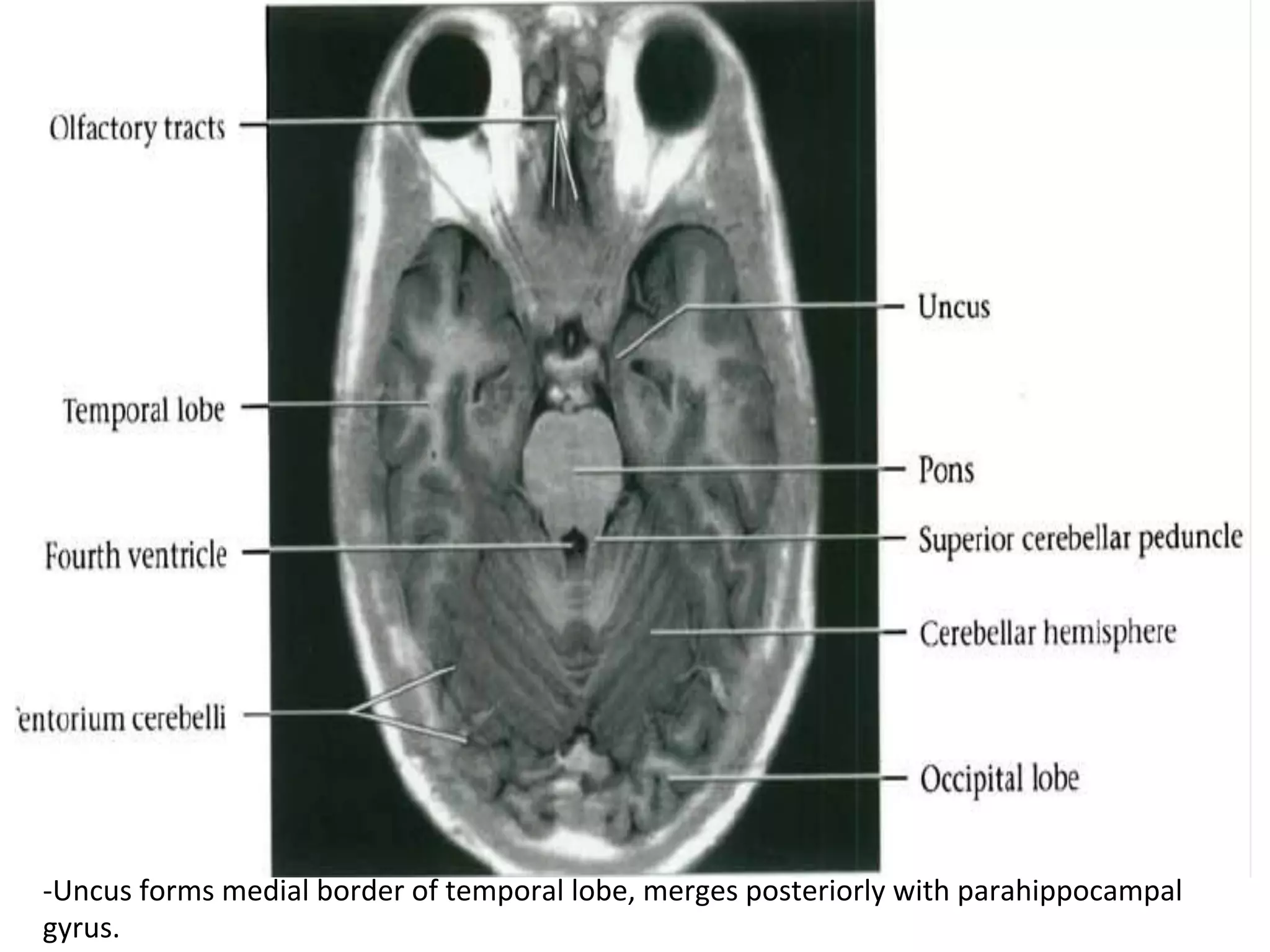 Brain anatomy new | PDF