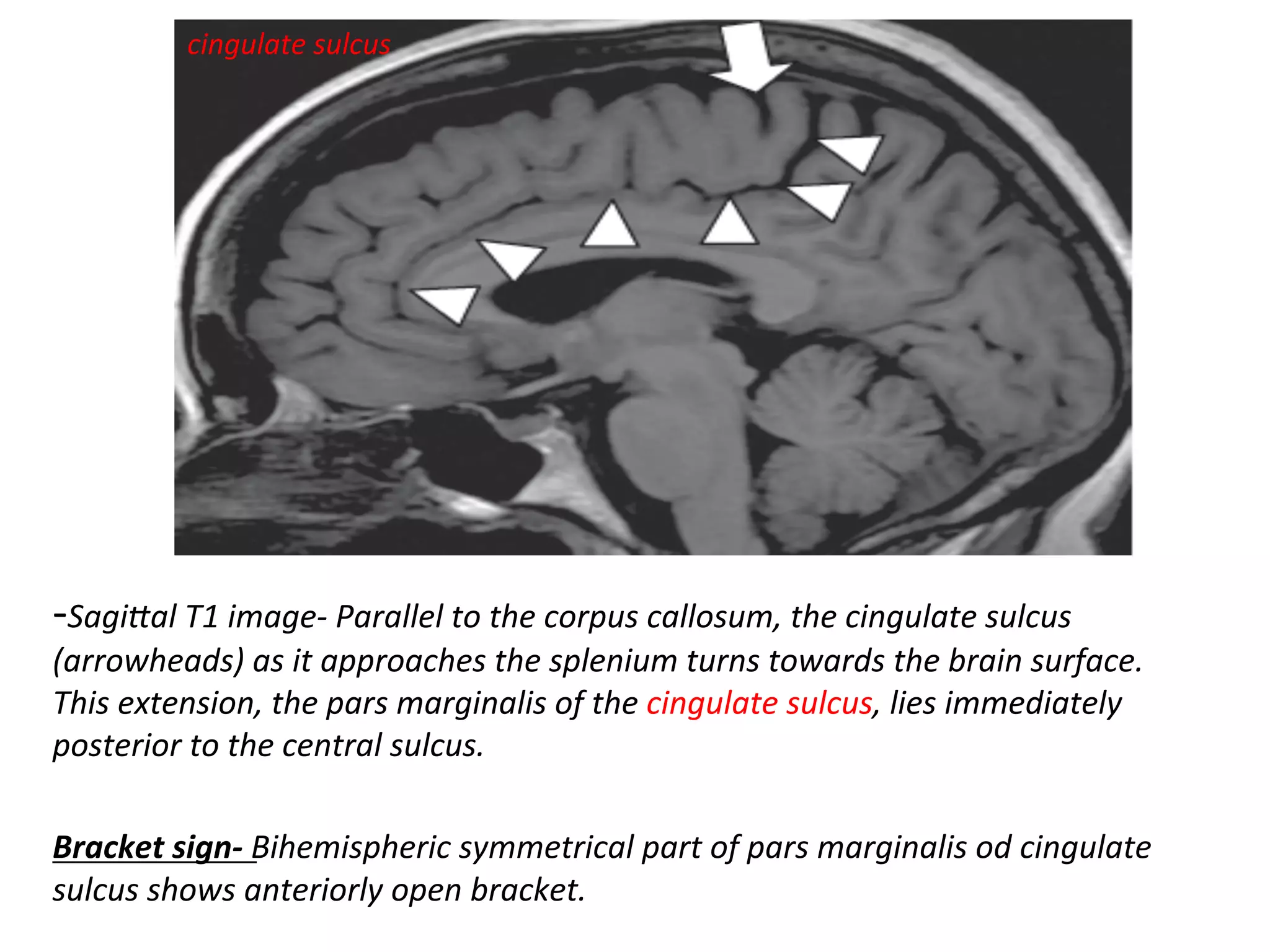 Brain anatomy new | PDF