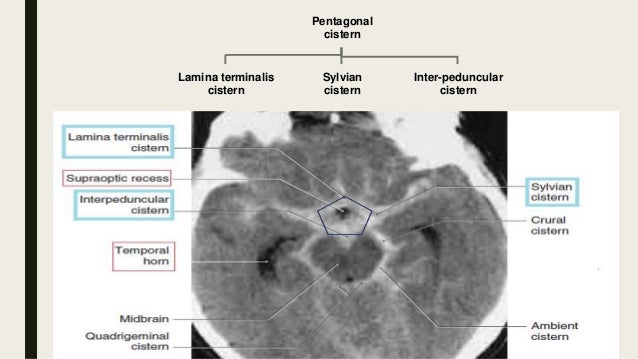 Brain anatomy (part 3)