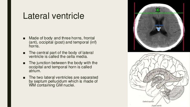 Brain anatomy (part 3)