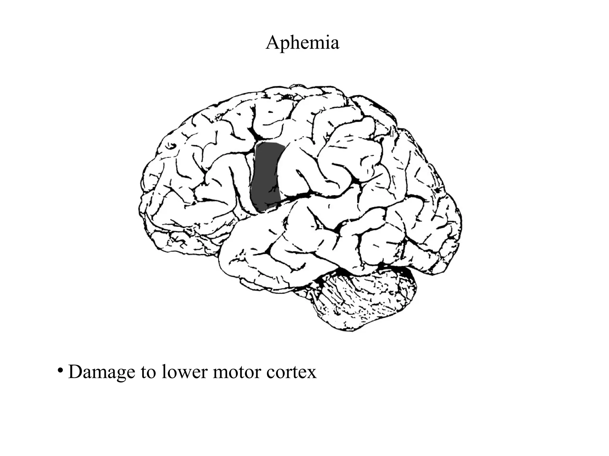 Brain And Aphasia | PPT