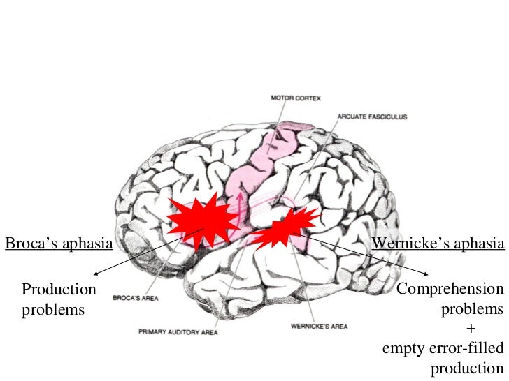 Brain And Aphasia