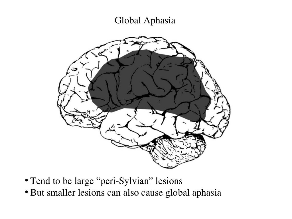 Brain And Aphasia